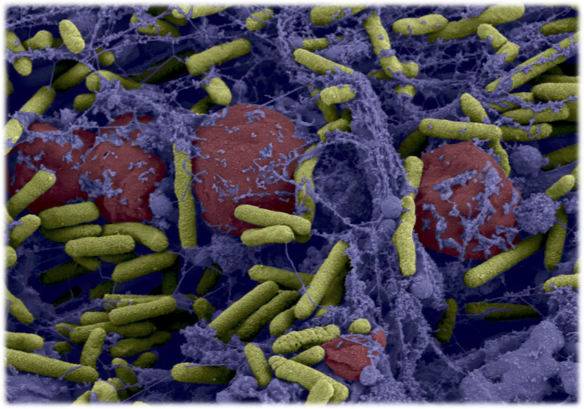 Master de Microbiologie – Plinius Cursus